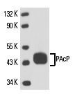 PAcP Antibody (PAP03) | SCBT - Santa Cruz Biotechnology