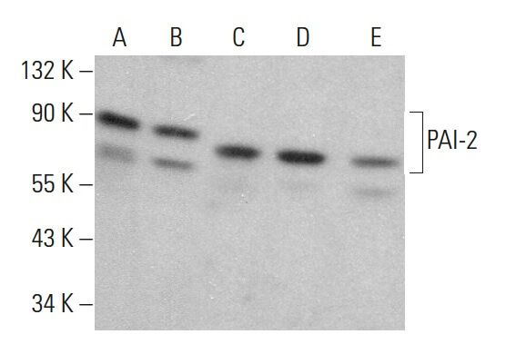 PAI-2 Antibody (E-1) | SCBT - Santa Cruz Biotechnology