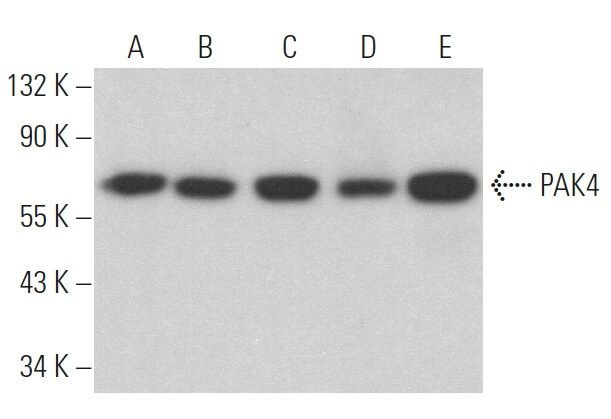PAK4 Antibody (B-3) | SCBT - Santa Cruz Biotechnology