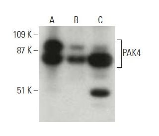 PAK4 Antibody (B-3) | SCBT - Santa Cruz Biotechnology