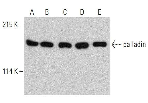 palladin Antibody (E-6) | SCBT - Santa Cruz Biotechnology