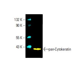 pan-Cytokeratin Antibody (AE13) - Western Blotting - Image 395827
