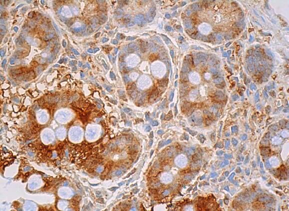 Anti-pan Ras Antibody (C-4) | SCBT - Santa Cruz Biotechnology