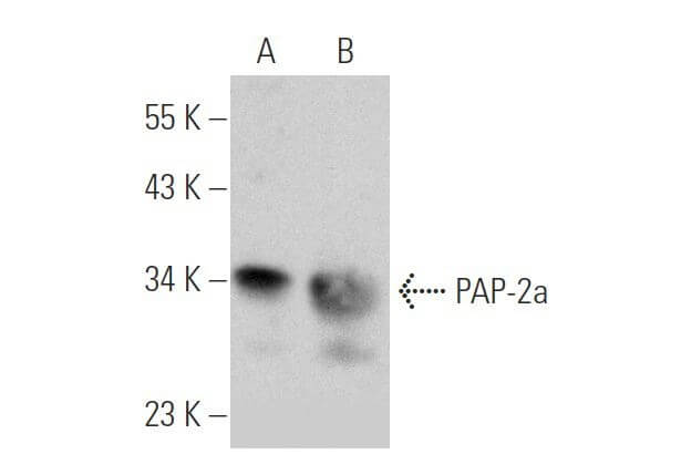 PAP-2a Antibody (A-4) | SCBT - Santa Cruz Biotechnology