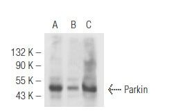 Parkin抗体 (D-1) | SCBT - Santa Cruz Biotechnology