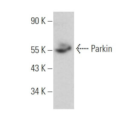 Anti-Parkin Antibody (H-8) | SCBT - Santa Cruz Biotechnology