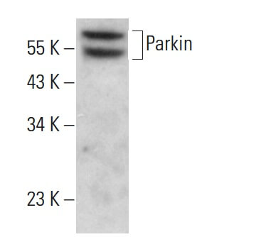 Anti-Parkin Antibody (H-8) | SCBT - Santa Cruz Biotechnology
