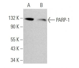 PARP-1 Antibody (F-2) - Western Blotting - Image 360404