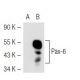 Pax-6抗体 (PAX6) | SCBT - Santa Cruz Biotechnology