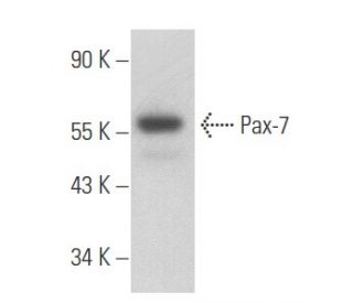 Pax-7 Antibody (PAX7) - Western Blotting - Image 357697