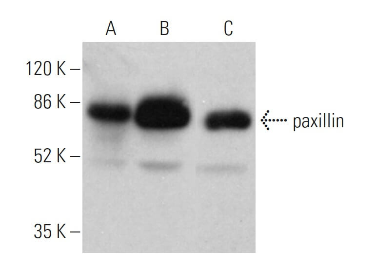 paxillin Antibody (A-5) | SCBT - Santa Cruz Biotechnology