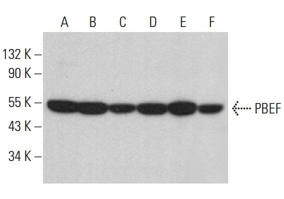 PBEF Antibody (E-3) | SCBT - Santa Cruz Biotechnology