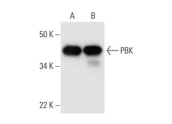 Anti-PBK Antibody (A-3) | SCBT - Santa Cruz Biotechnology