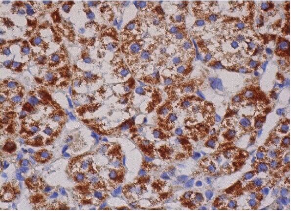 PCCA抗体 (D-5) | SCBT - Santa Cruz Biotechnology