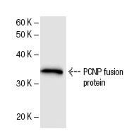 PCNP Antibody (2707C2a) | SCBT - Santa Cruz Biotechnology