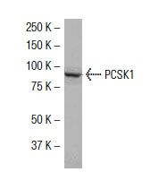 PCSK1 Antibody (J-18) | SCBT - Santa Cruz Biotechnology
