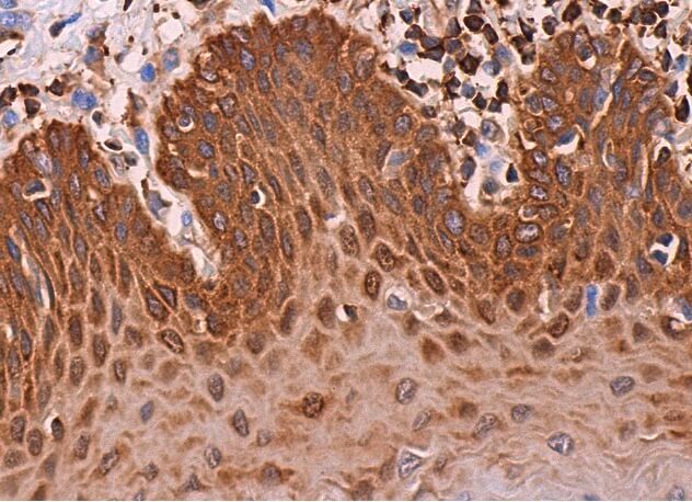 Anti-Pdcd-4 Antibody (B-4) | SCBT - Santa Cruz Biotechnology