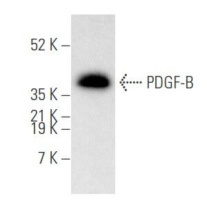PDGF-B抗体 (C-5) | SCBT - Santa Cruz Biotechnology