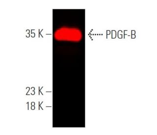 Anti-PDGF-B Antibody (F-3) | SCBT - Santa Cruz Biotechnology