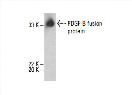 Anti-PDGF-B Antibody (F-3) | SCBT - Santa Cruz Biotechnology