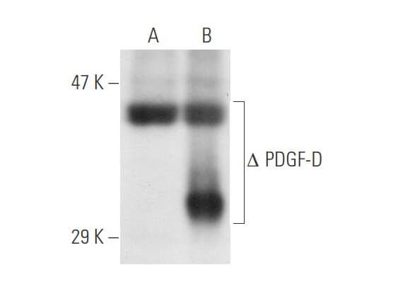 PDGF-D Antibody (E-3) | SCBT - Santa Cruz Biotechnology