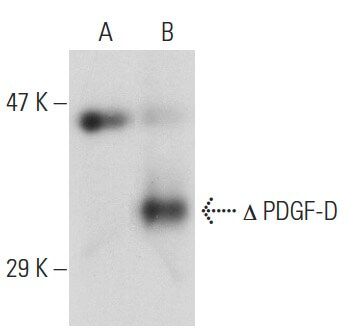 PDGF-D Antibody (E-6) | SCBT - Santa Cruz Biotechnology
