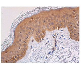 PDGFR-α Antibody (C-9) - Immunohistochemistry - Image 351532