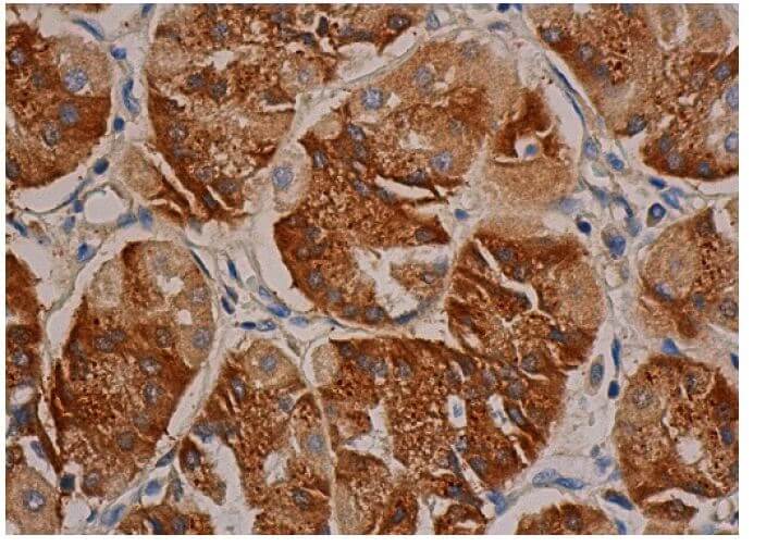 Anti-PDGF Receptor beta/PDGFR-β Antibody (18A2) | SCBT - Santa Cruz ...