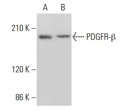 Anti-PDGF Receptor beta/PDGFR-β Antibody (D-6) | SCBT - Santa Cruz ...