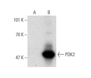 PDK2 Antibody (S-15) - Western Blotting - Image 139188