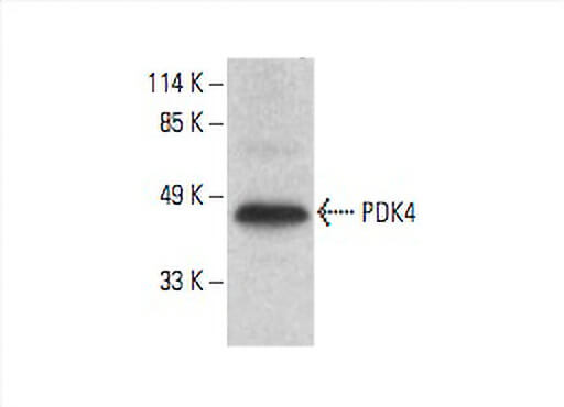 PDK4 Antibody (B-1) | SCBT - Santa Cruz Biotechnology