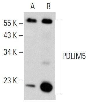 PDLIM5 Antibody (G-2) | SCBT - Santa Cruz Biotechnology