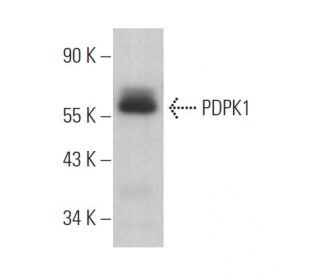 Anti-PDPK1 Antibody (E-3) | SCBT - Santa Cruz Biotechnology