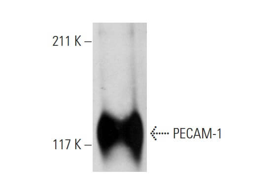 CD31/PECAM-1 Antibody (D-11) | SCBT - Santa Cruz Biotechnology