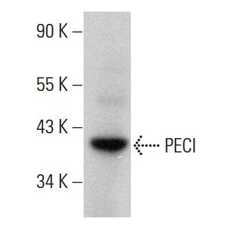 PECI Antibody (32) | SCBT - Santa Cruz Biotechnology