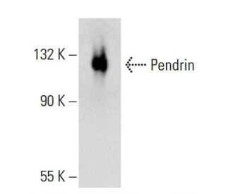 Pendrin Antibody (C-2) | SCBT - Santa Cruz Biotechnology