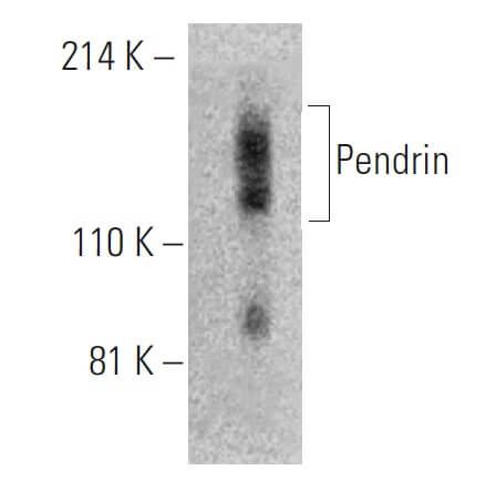 Pendrin Antibody (G-11) | SCBT - Santa Cruz Biotechnology