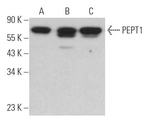 PEPT1 Antibody (E-3) | SCBT - Santa Cruz Biotechnology