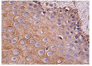 Anti-Perforin 1 Antibody (E-5) | SCBT - Santa Cruz Biotechnology