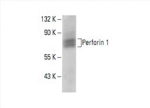 Anti-Perforin 1 Antibody (E-5) | SCBT - Santa Cruz Biotechnology