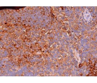 Anti-Perforin 1 Antibody (F-1) | SCBT - Santa Cruz Biotechnology