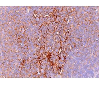 Perforin 1 Antibody (F-1) | SCBT - Santa Cruz Biotechnology