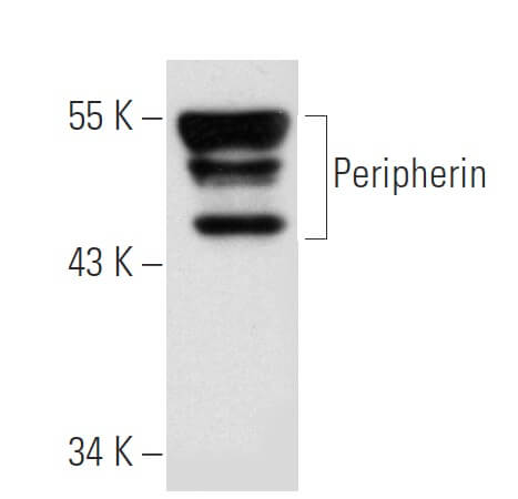 Peripherin Antibody (8G2) | SCBT - Santa Cruz Biotechnology