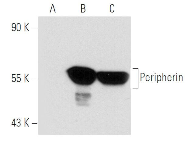 Peripherin Antibody (8G2) | SCBT - Santa Cruz Biotechnology