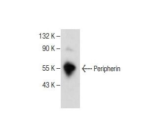 Anti-Peripherin Antibody (A-3) | SCBT - Santa Cruz Biotechnology