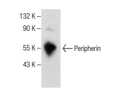 Anti-Peripherin Antibody (A-3) | SCBT - Santa Cruz Biotechnology