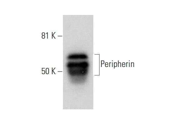Anti-Peripherin Antibody (A-3) | SCBT - Santa Cruz Biotechnology