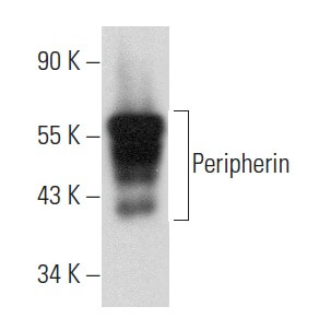 Anti-Peripherin Antibody (A-3) | SCBT - Santa Cruz Biotechnology