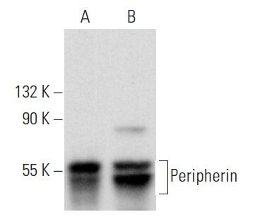 Peripherin Antibody (A-3) | SCBT - Santa Cruz Biotechnology