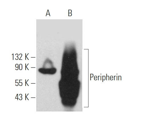 Anti-Peripherin Antibody (A-3) | SCBT - Santa Cruz Biotechnology
